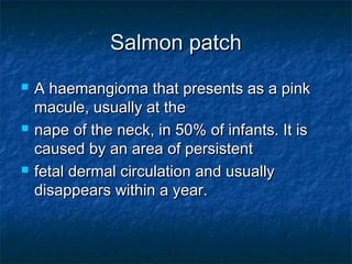 Hemangioma | PPT