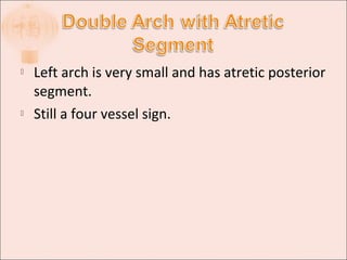 Vascular anomalies of aorta | PPT