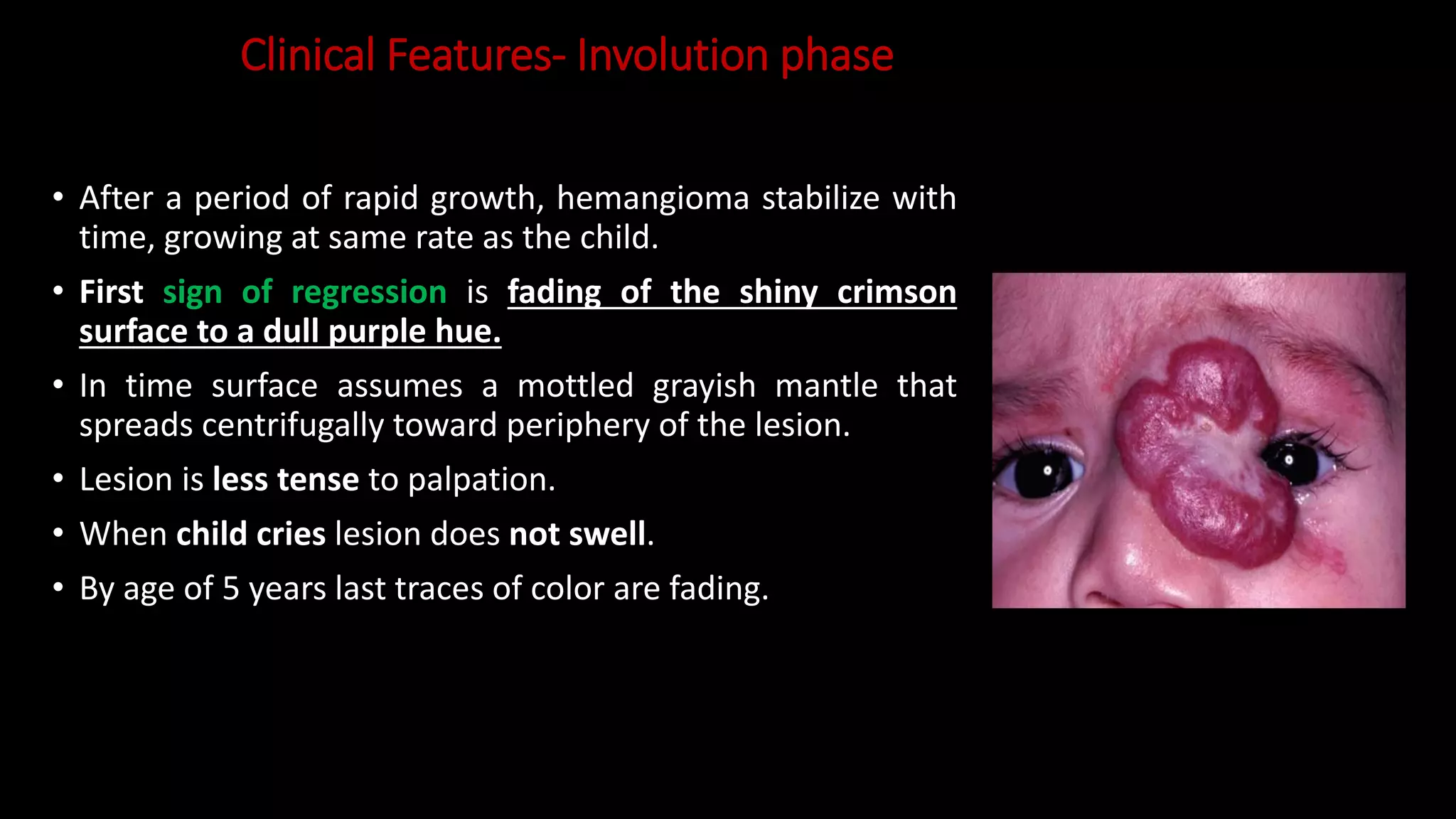 Vascular anomalies of head and neck | PPTX