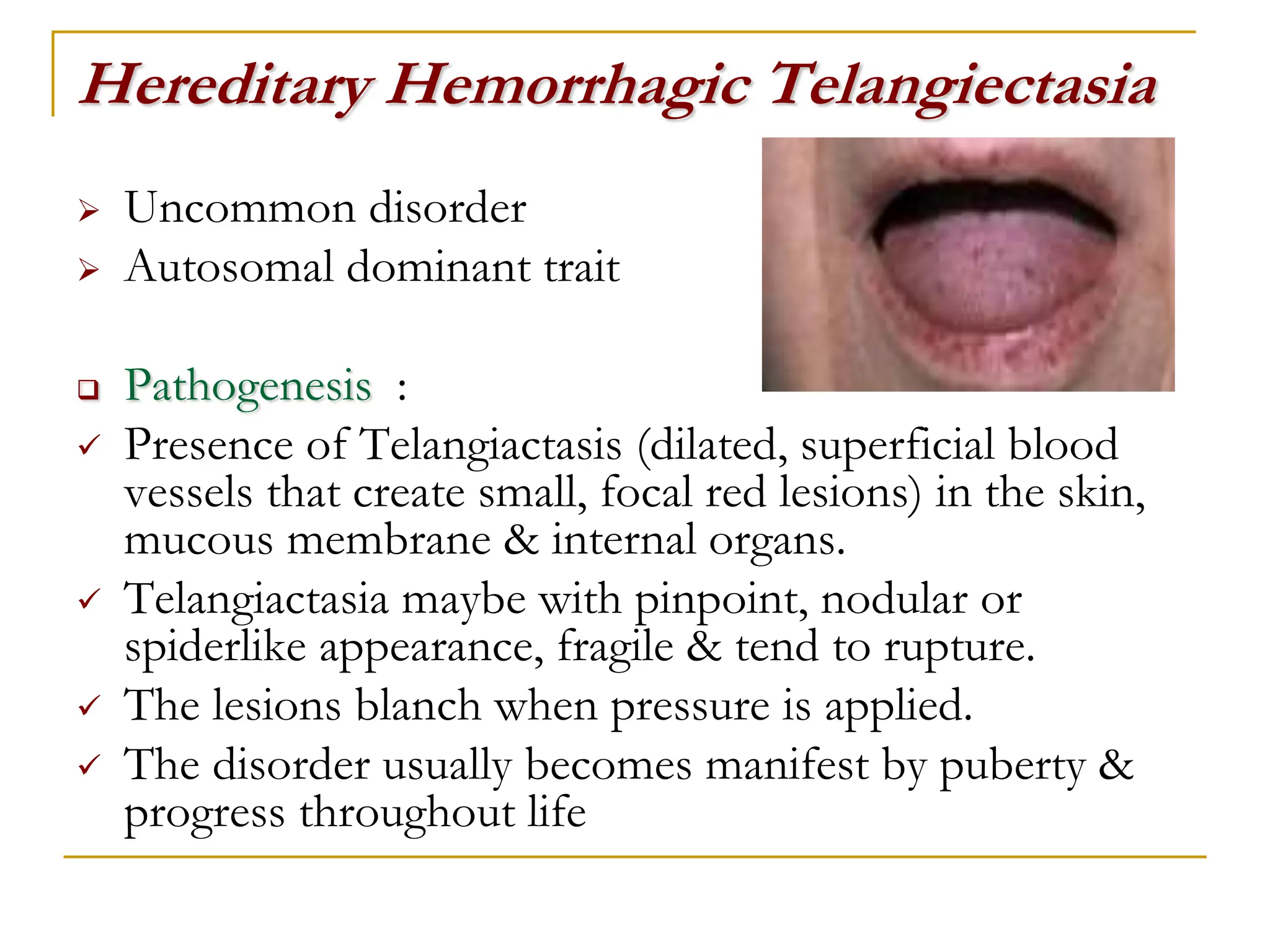 vascular Bleeding Disorders.ppt
