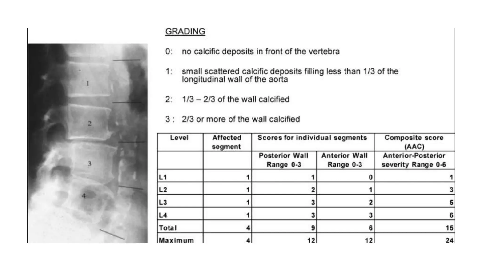 vascular calcification.pptx