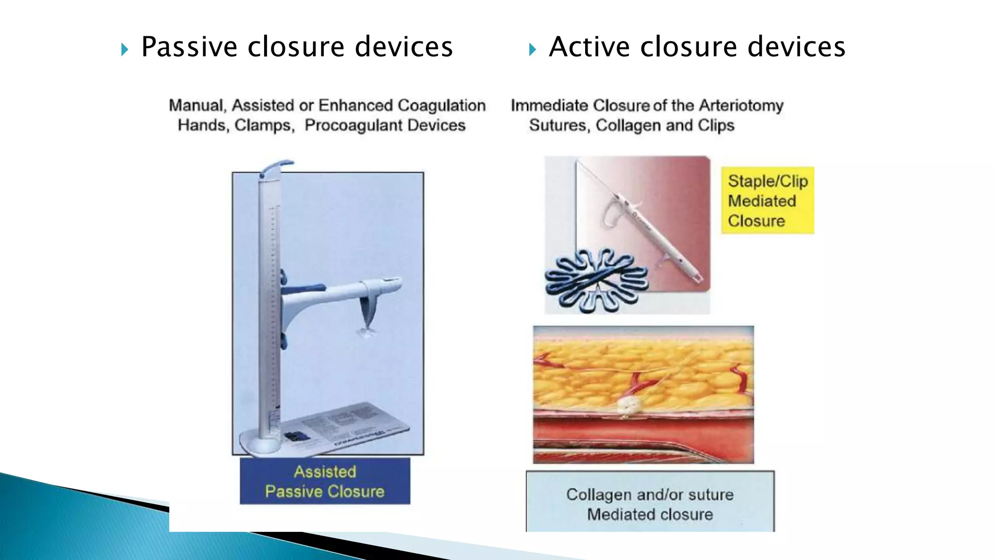 Vascular closure device.pptx | First Aid | Injuries