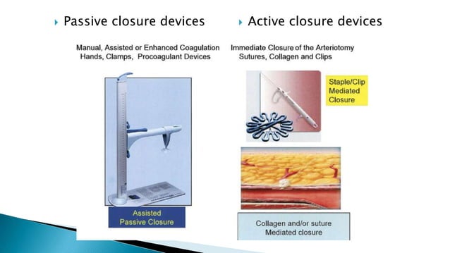 Vascular closure device.pptx | First Aid | Injuries