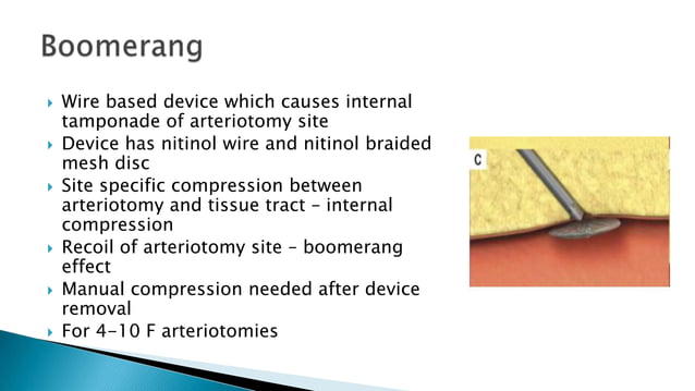 Vascular closure device.pptx | First Aid | Injuries