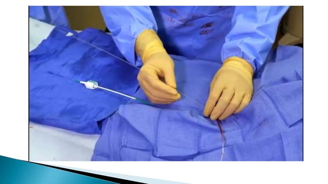 Vascular closure device.pptx | First Aid | Injuries