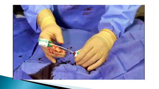 Vascular closure device.pptx | First Aid | Injuries