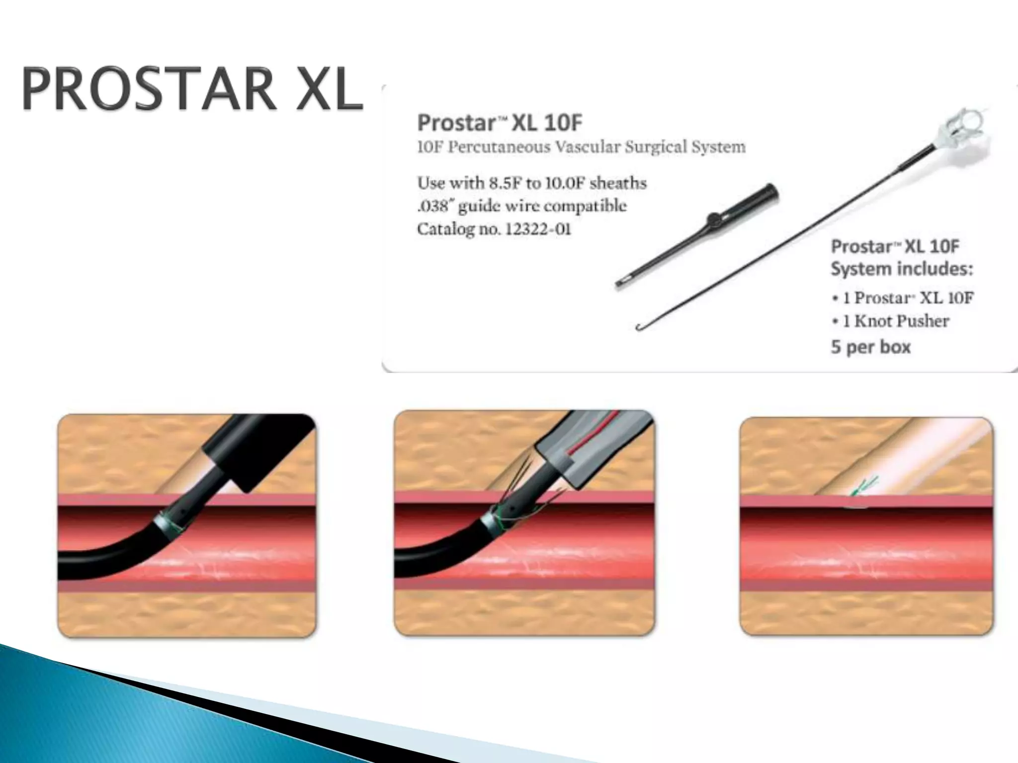 vascular closure devices II.pptx