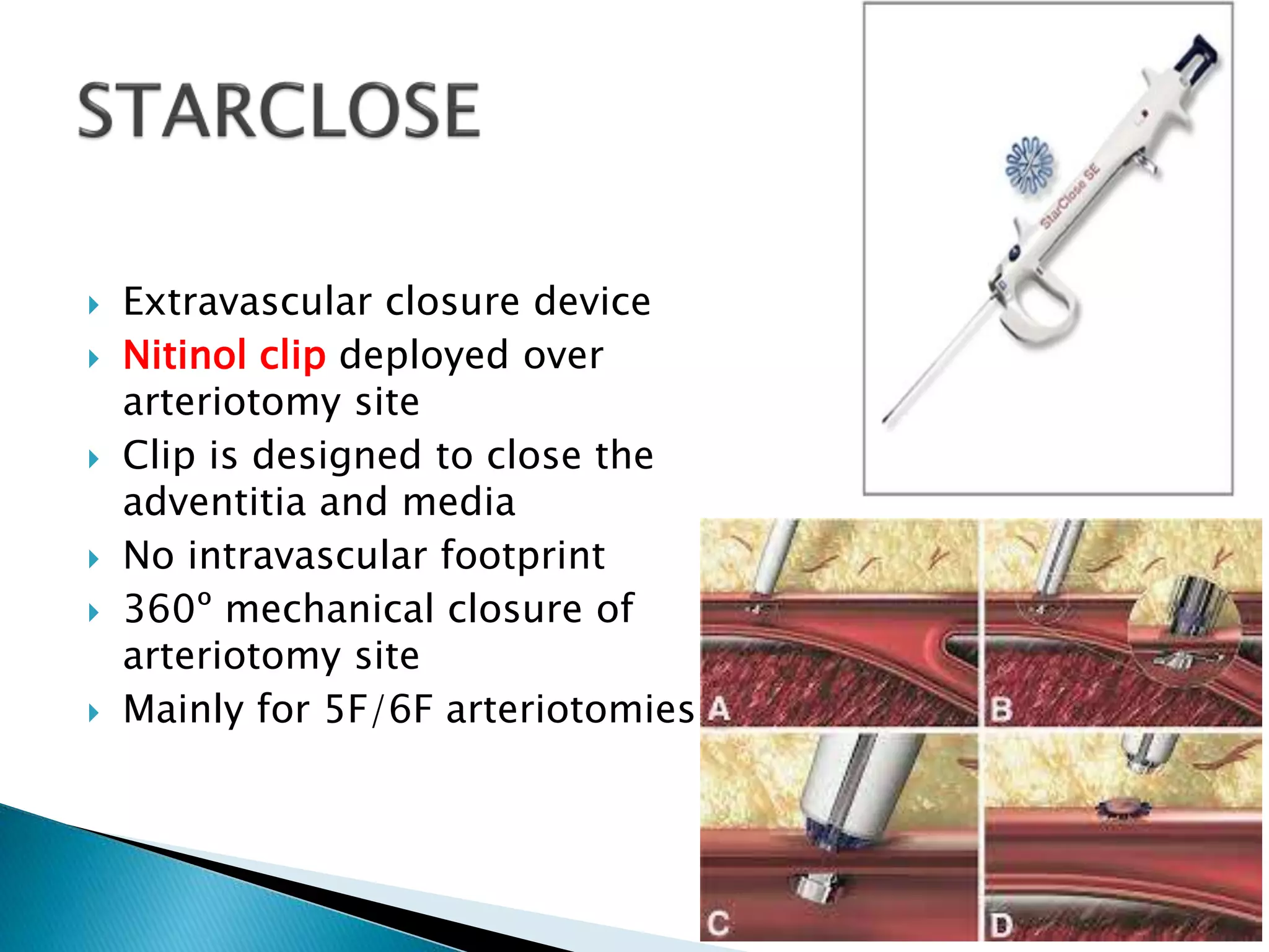 vascular closure devices II.pptx