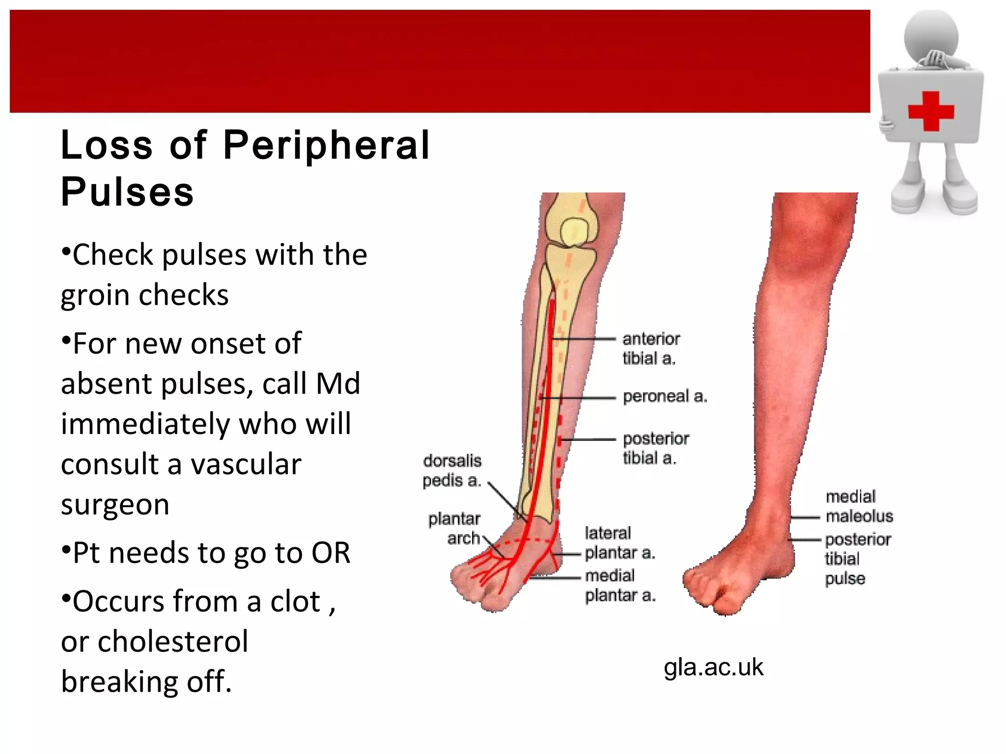 Vascular complications post cardiac catherization | PPT