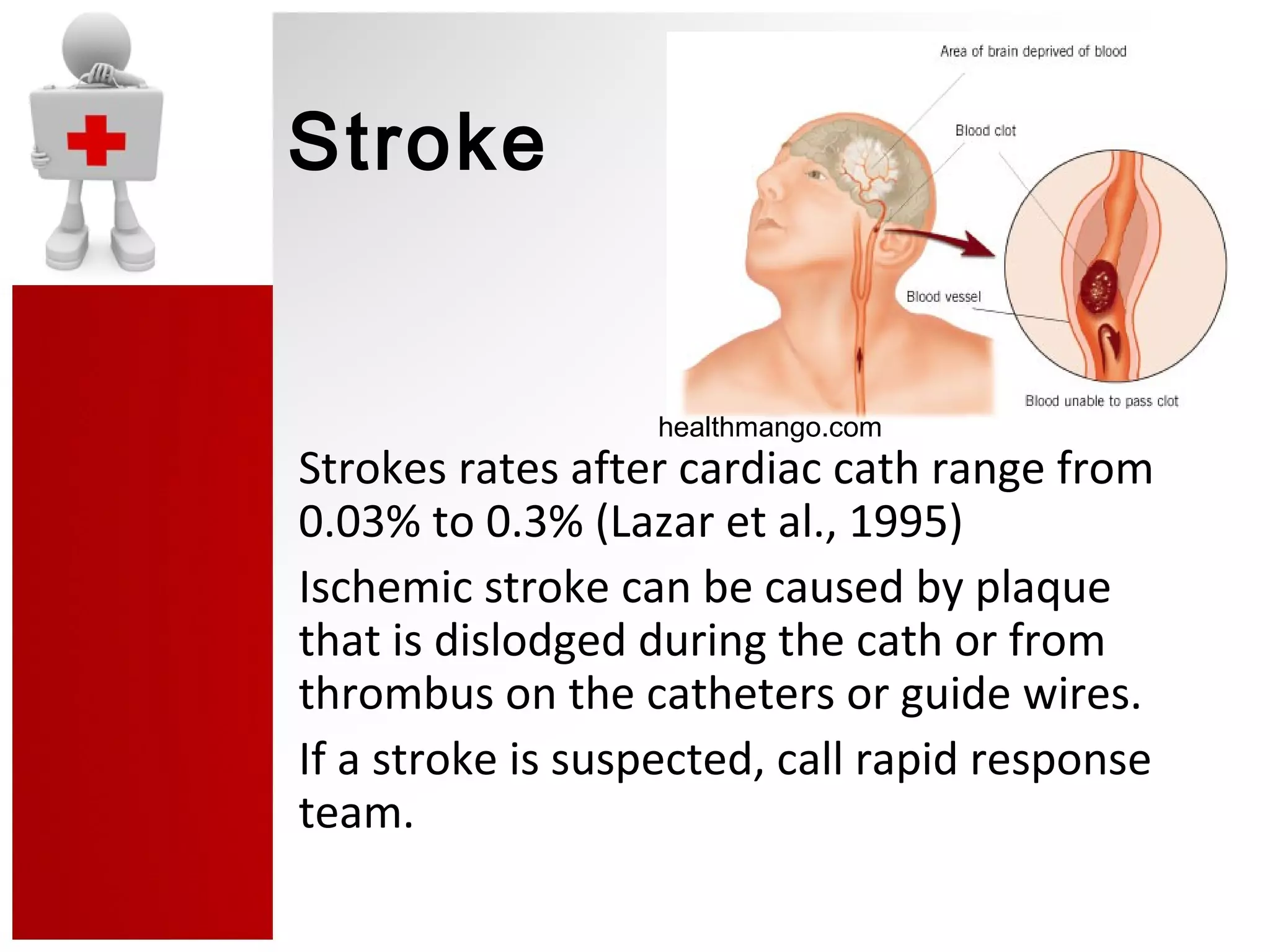Vascular complications post cardiac catherization | PPT