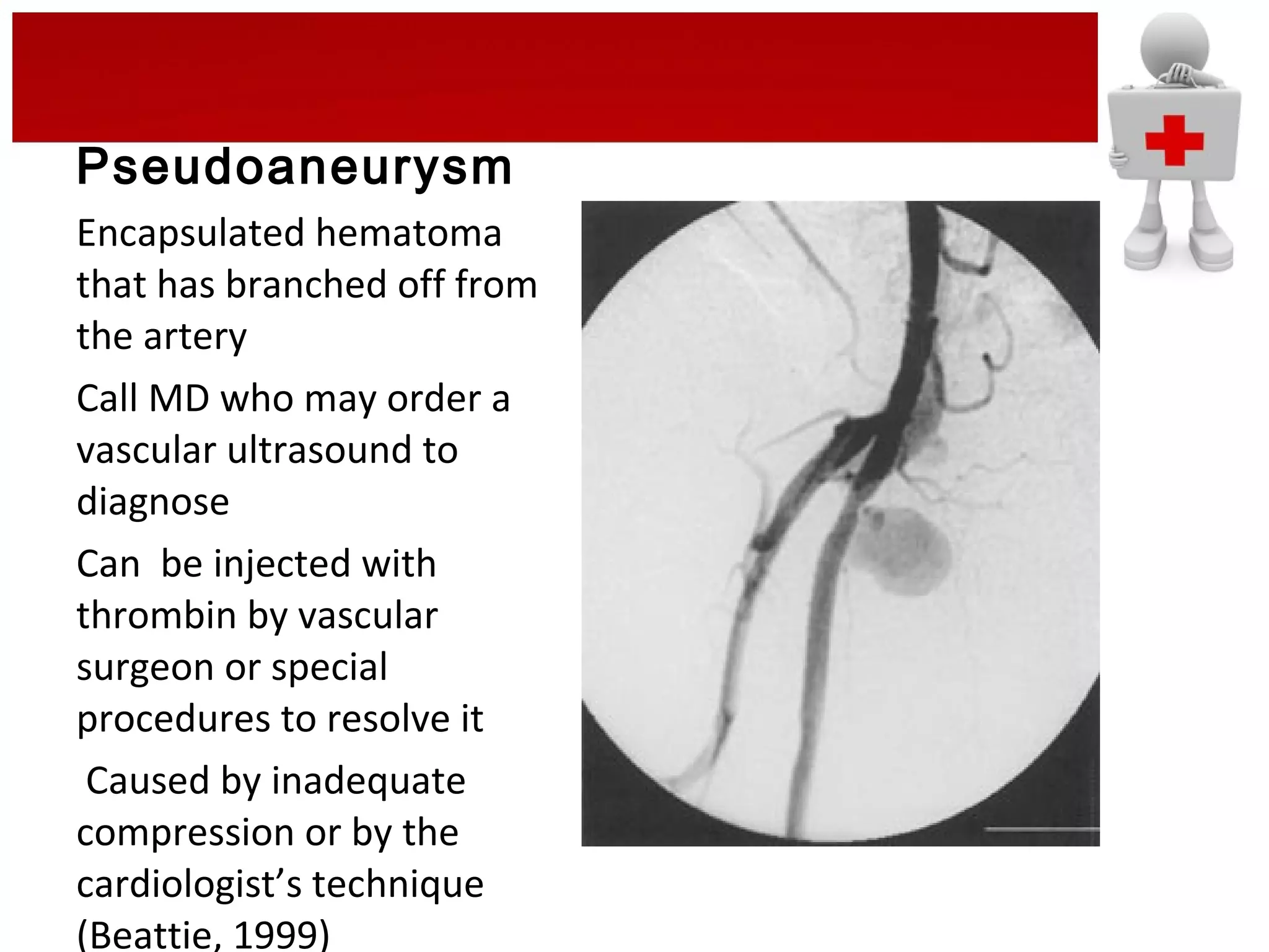 Vascular complications post cardiac catherization | PPT