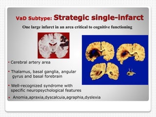 Vascular Dementia | PPTX