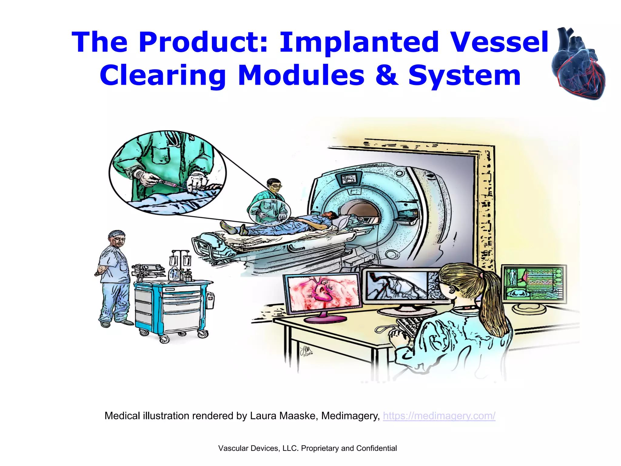 Vascular devices llc_implanted_vessel_clearing_modules_&_system_02-21 ...