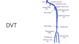 Vascular/DVT Ultrasound - CUSIC 2015 | PPT