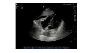 Vascular/DVT Ultrasound - CUSIC 2015 | PPT