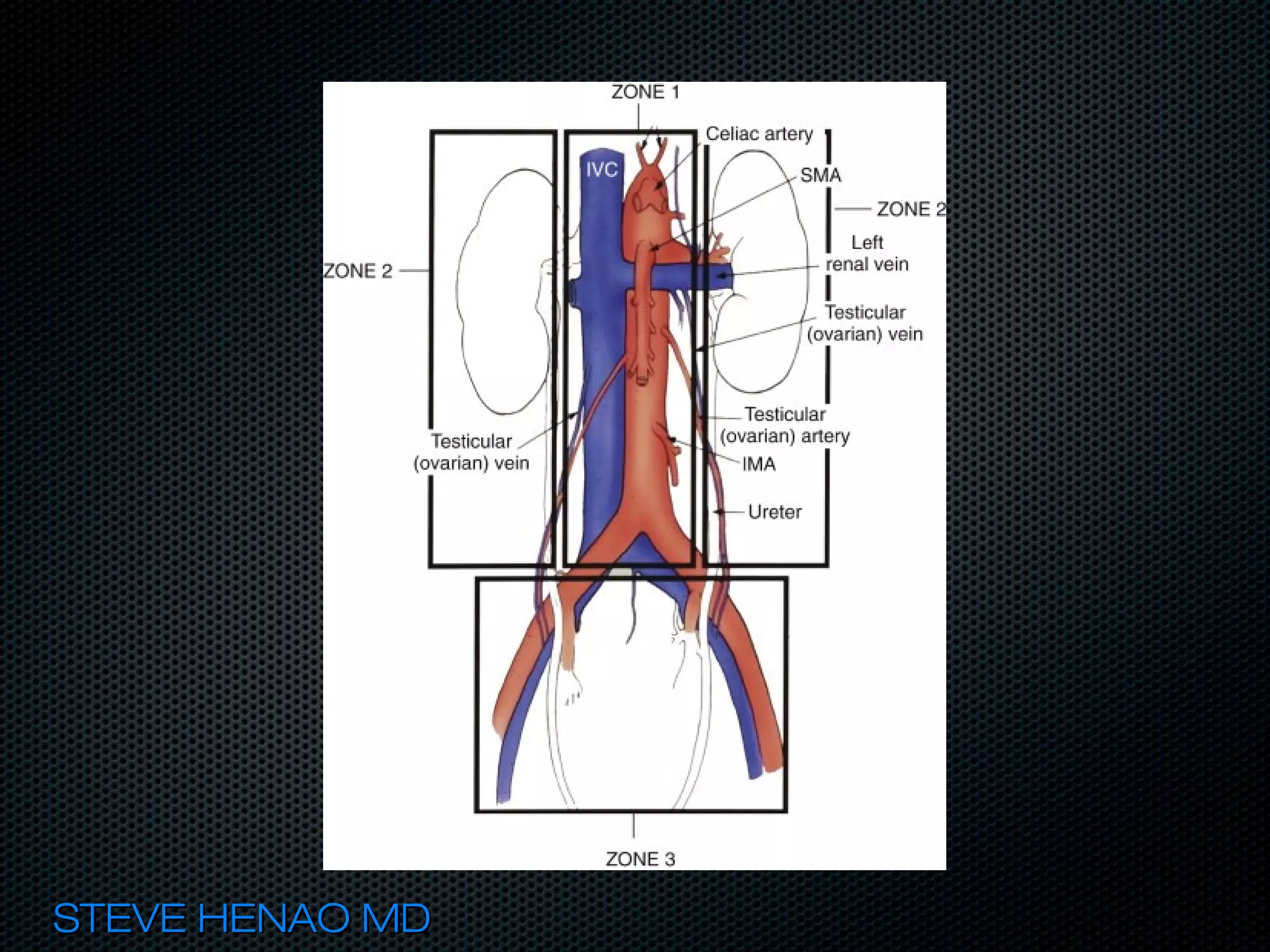 Vascular Emergencies | PPT