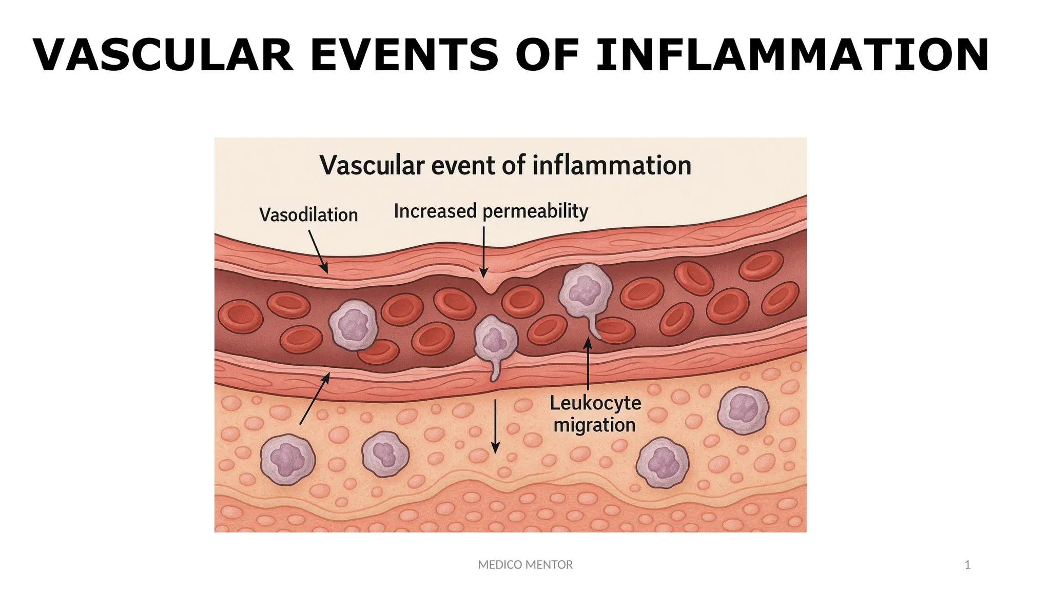MECHANISM OF VASCULAR EVENTS OF INFLAMMATION.pptx