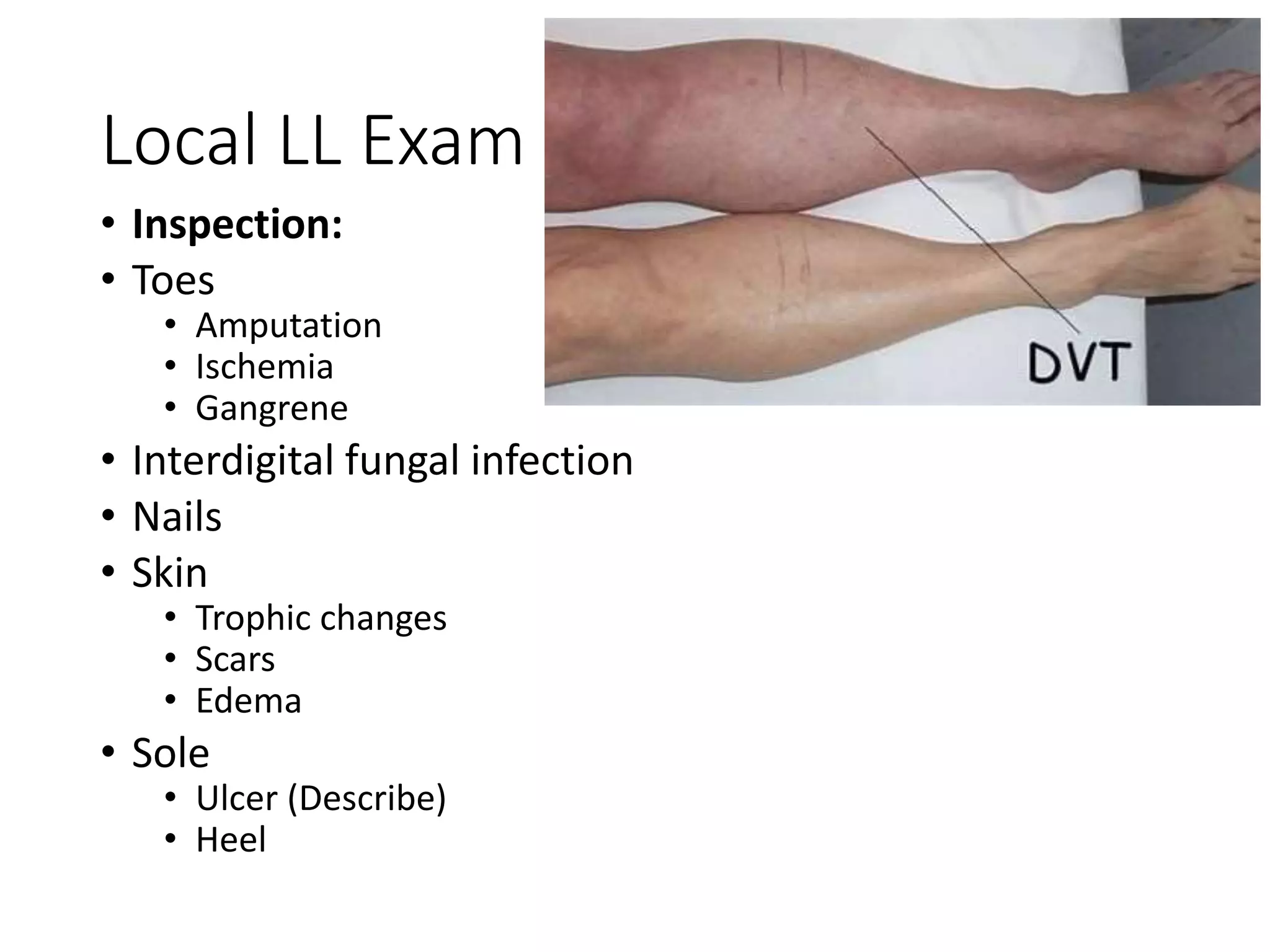 Lower limb vascular examination | PPTX | Heart and Cardiovascular ...