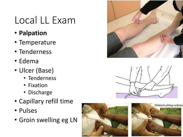 Lower limb vascular examination | PPTX | Heart and Cardiovascular ...