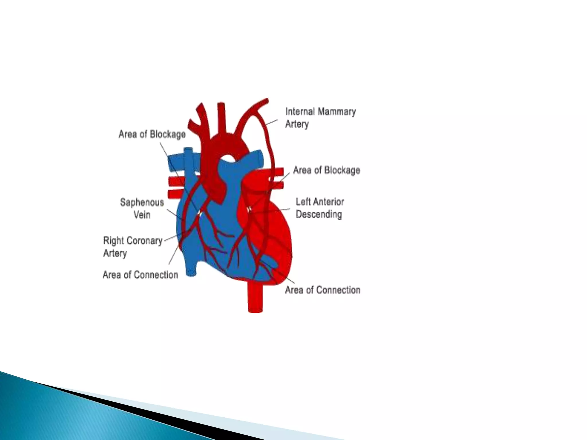 Vascular graft | PPTX