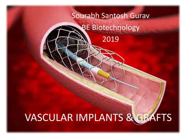 Vascular implants & grafts | PPT