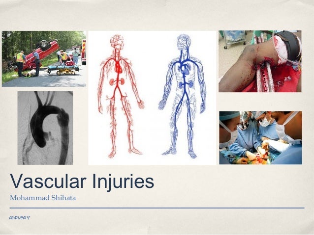 Vascular injuries