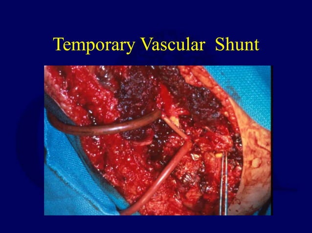 vascular injuries.pptx