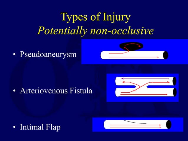 vascular injuries.pptx