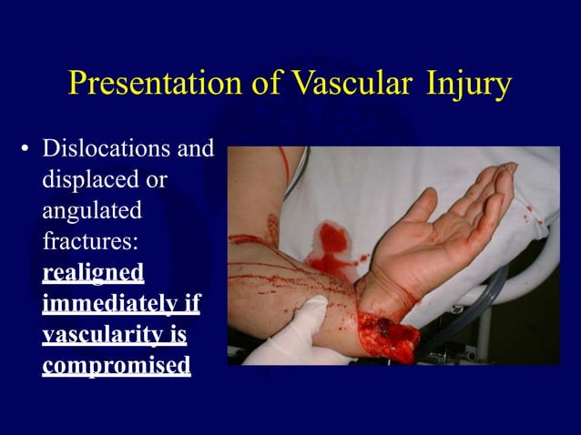 vascular injuries.pptx