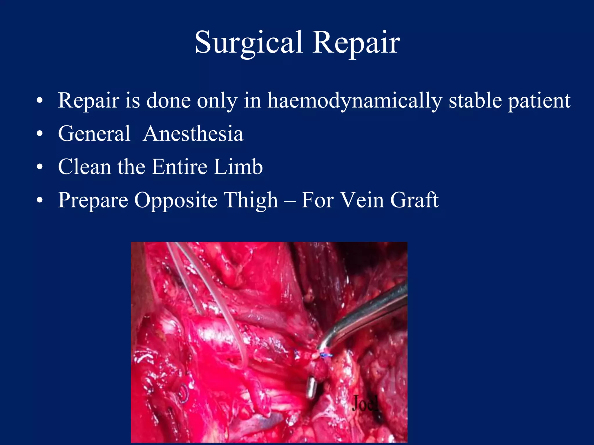 Vascular injuries and Principles of management 2021 | PPT