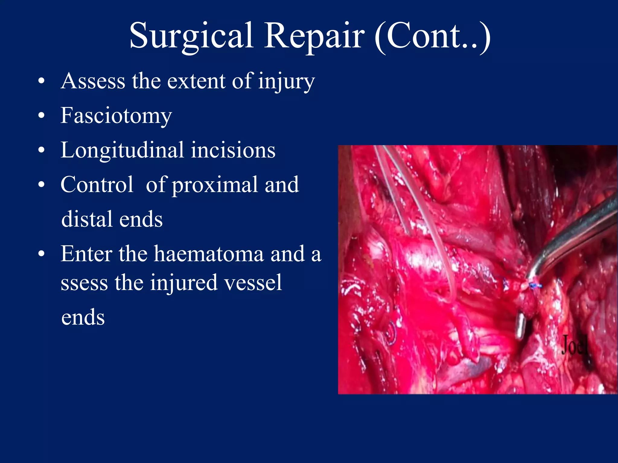 Vascular injuries and Principles of management 2021 | PPT