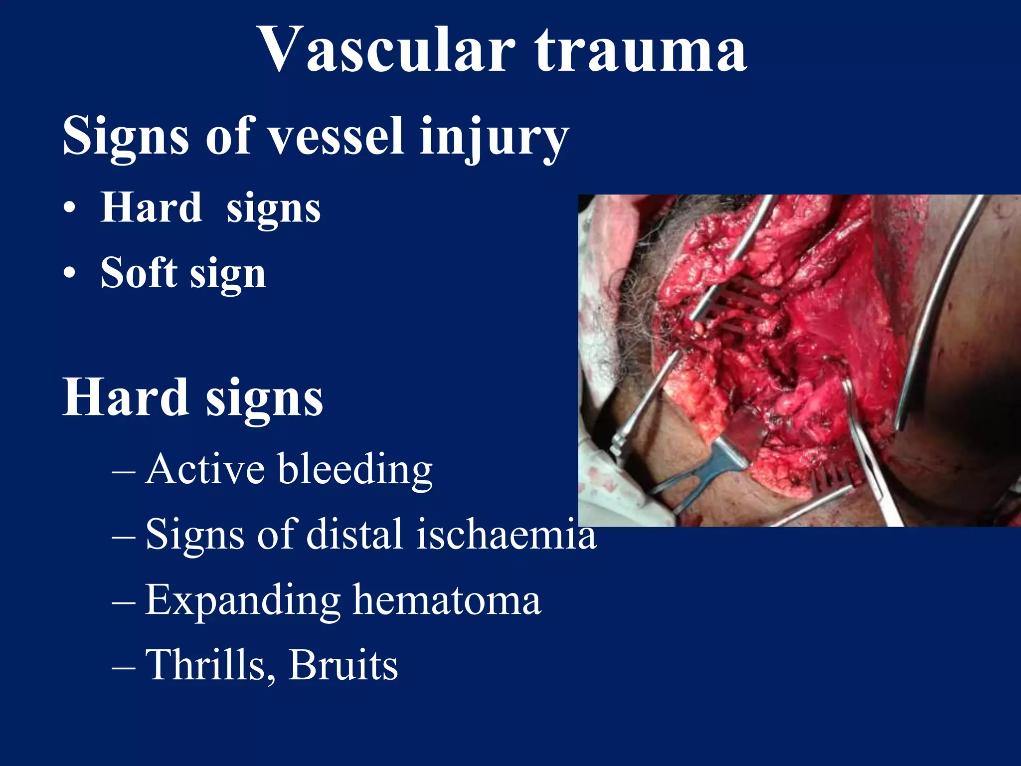 Vascular injuries and Principles of management 2021 | PPT