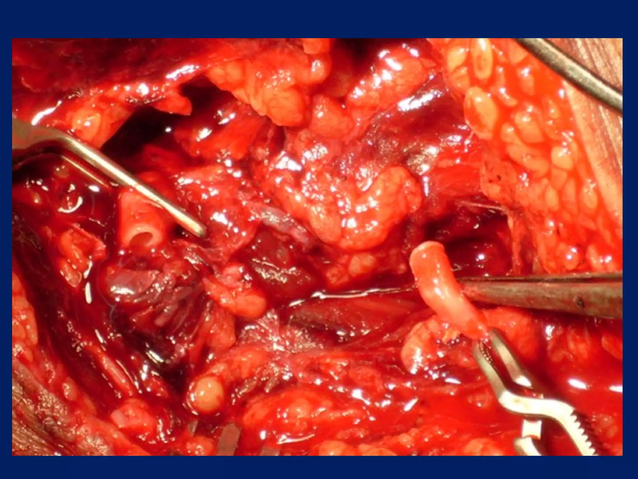 Vascular injuries and management 2018 | PPT