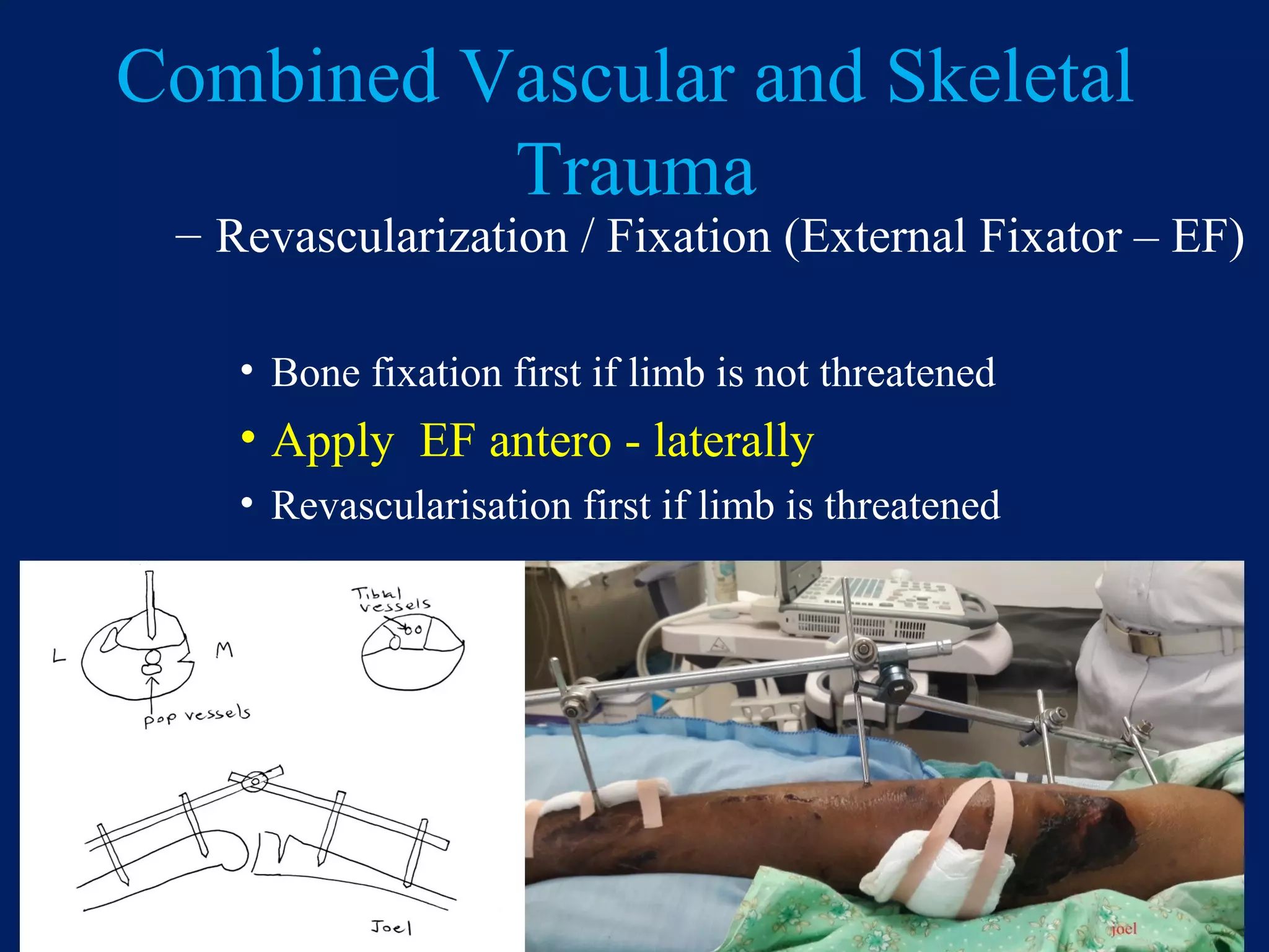 Vascular injuries and management 2018 | PPT
