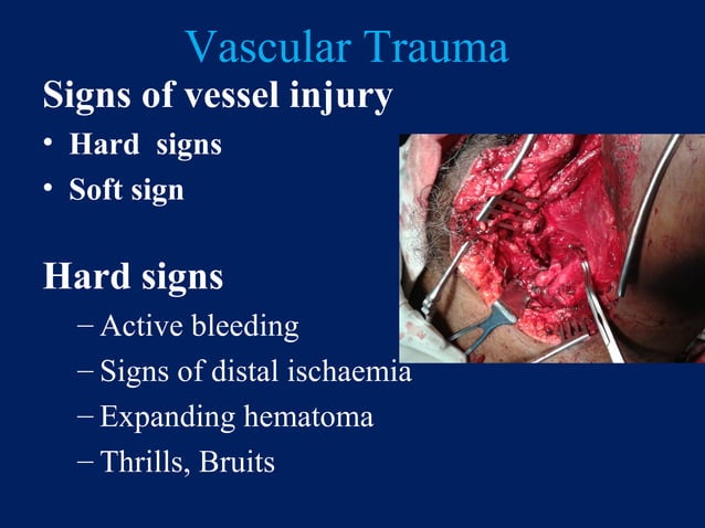Vascular injuries and management 2018 | PPT | First Aid | Injuries