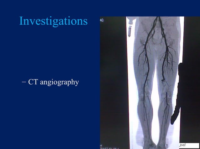 Vascular injuries and management 2018 | PPT | First Aid | Injuries