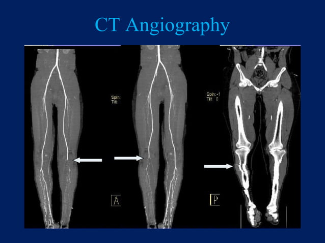 Vascular injuries and management 2018 | PPT | First Aid | Injuries