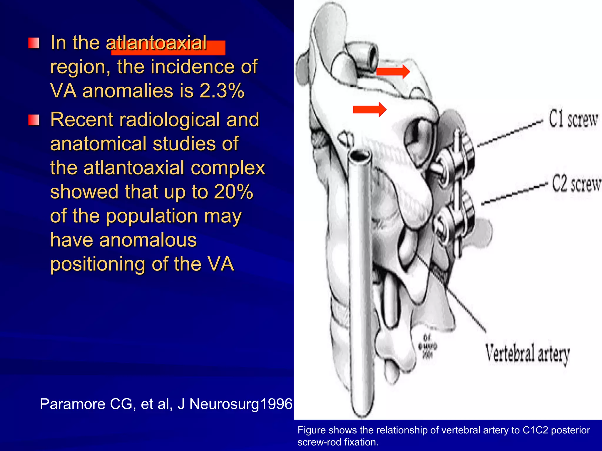 Vascular injury at Cervical Spine MAY 2022.ppt