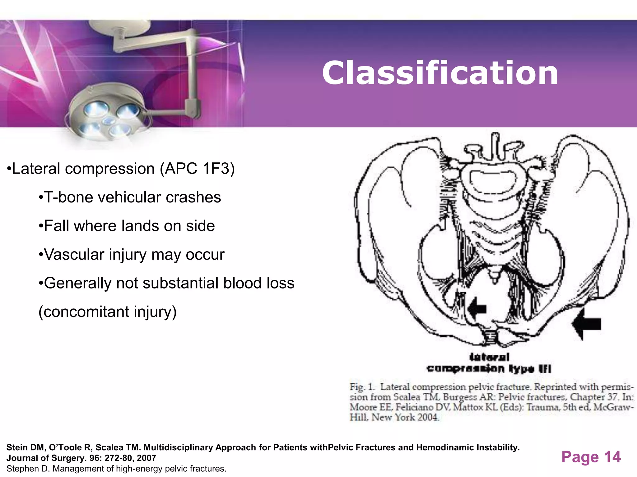 Vascular injury in pelvic trauma | PPSX