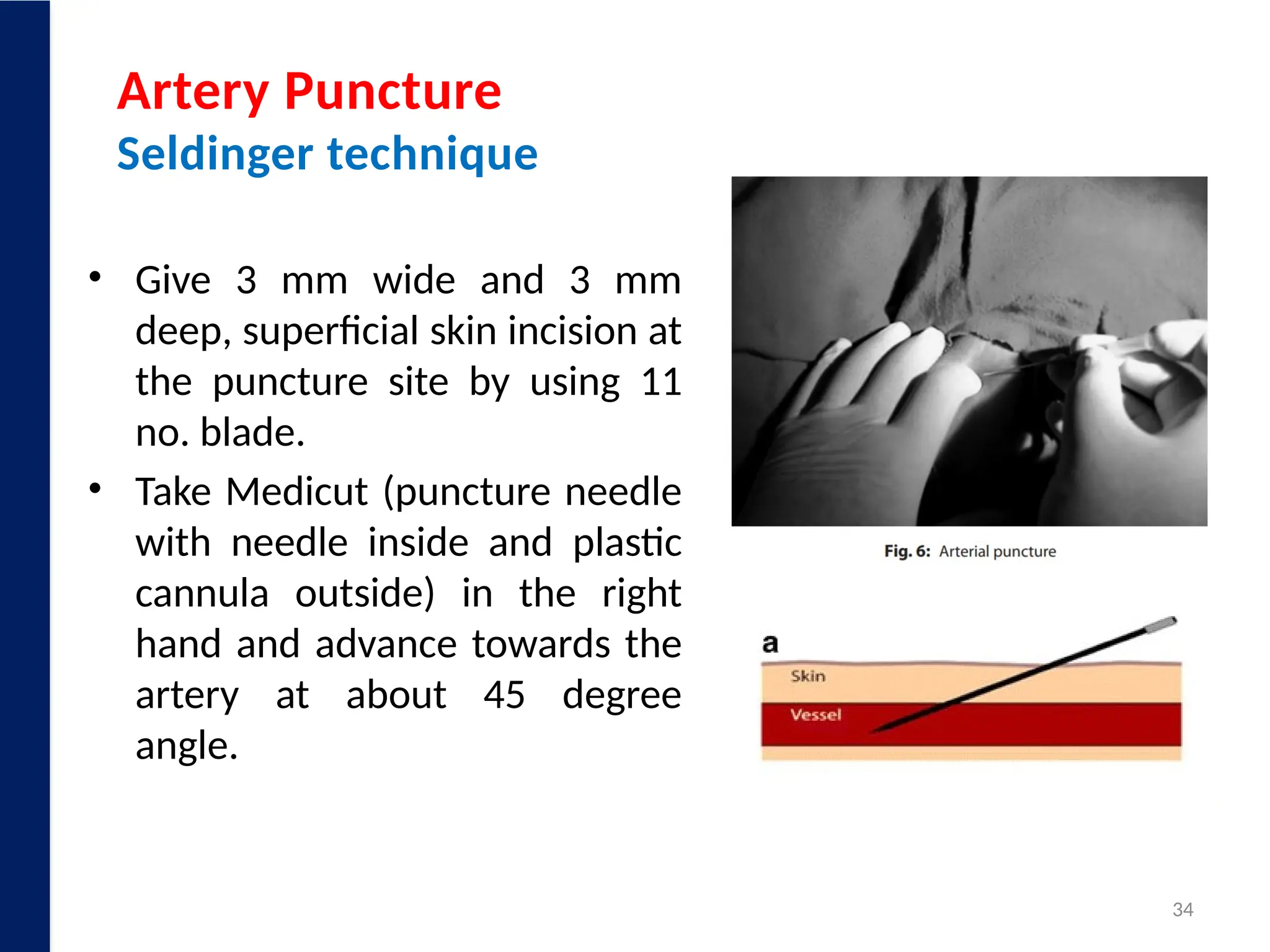 VASCULAR INTERVENTIONAL STUDIES by joginder.pptx