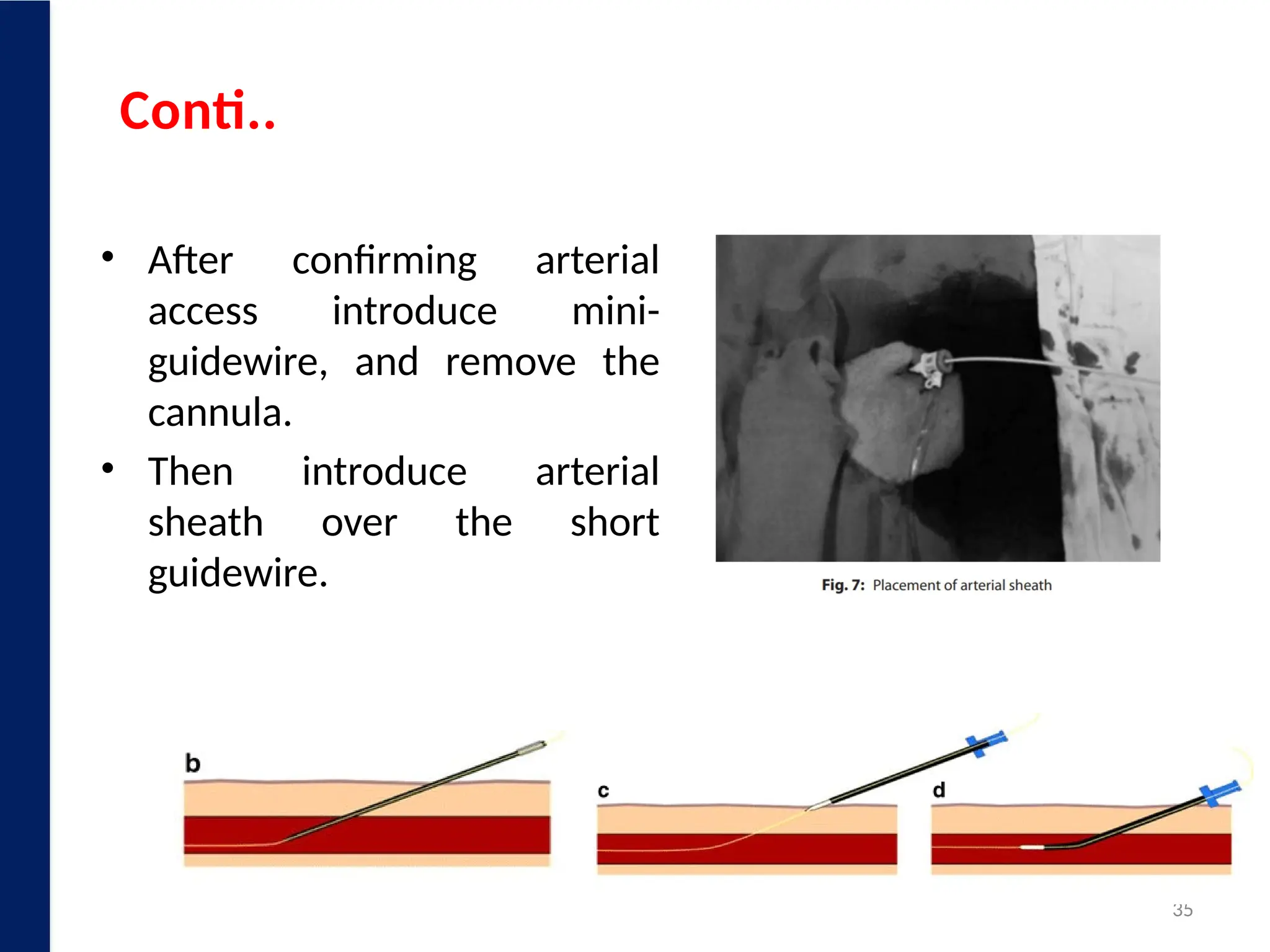 VASCULAR INTERVENTIONAL STUDIES by joginder.pptx