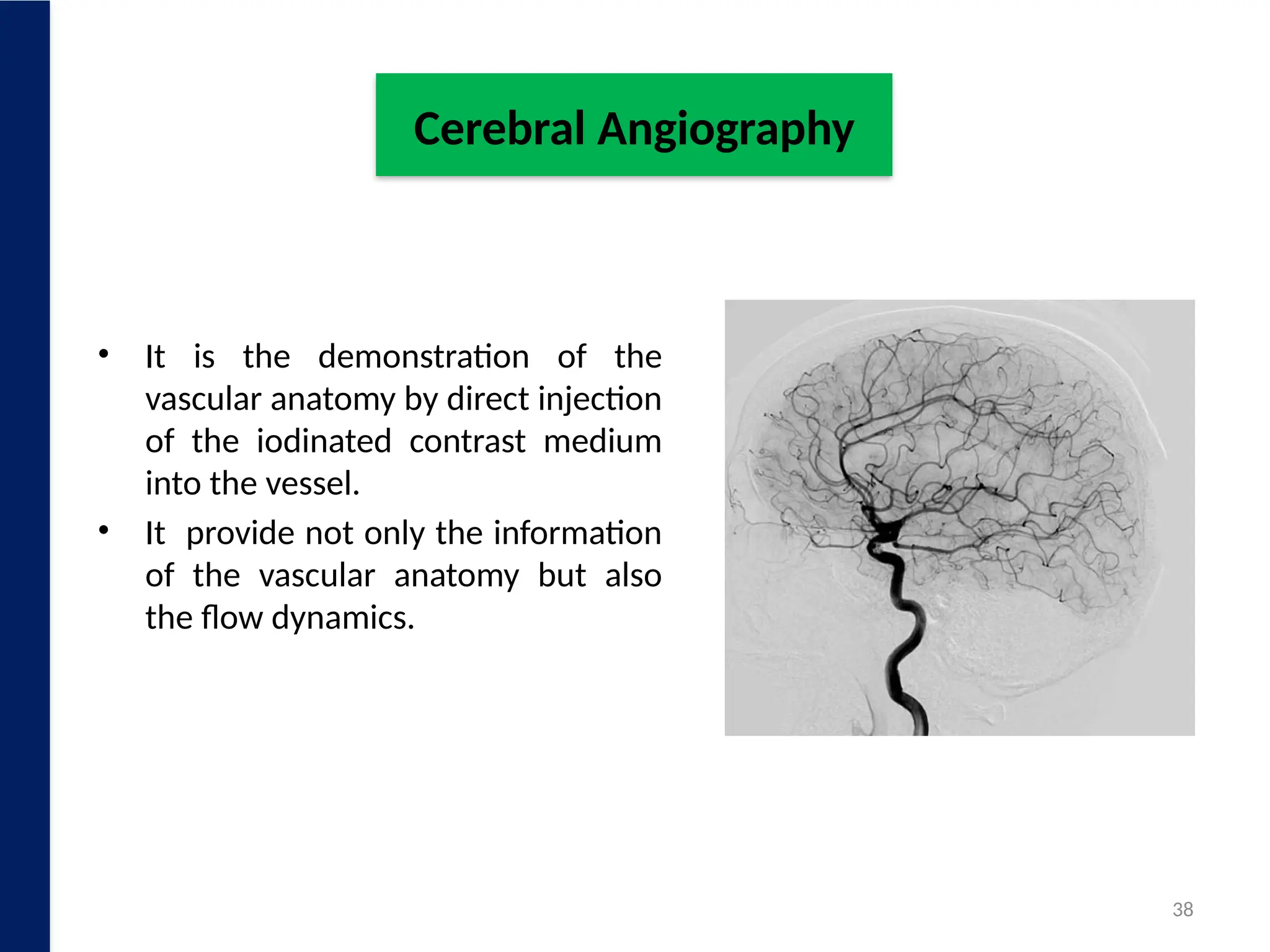 VASCULAR INTERVENTIONAL STUDIES by joginder.pptx