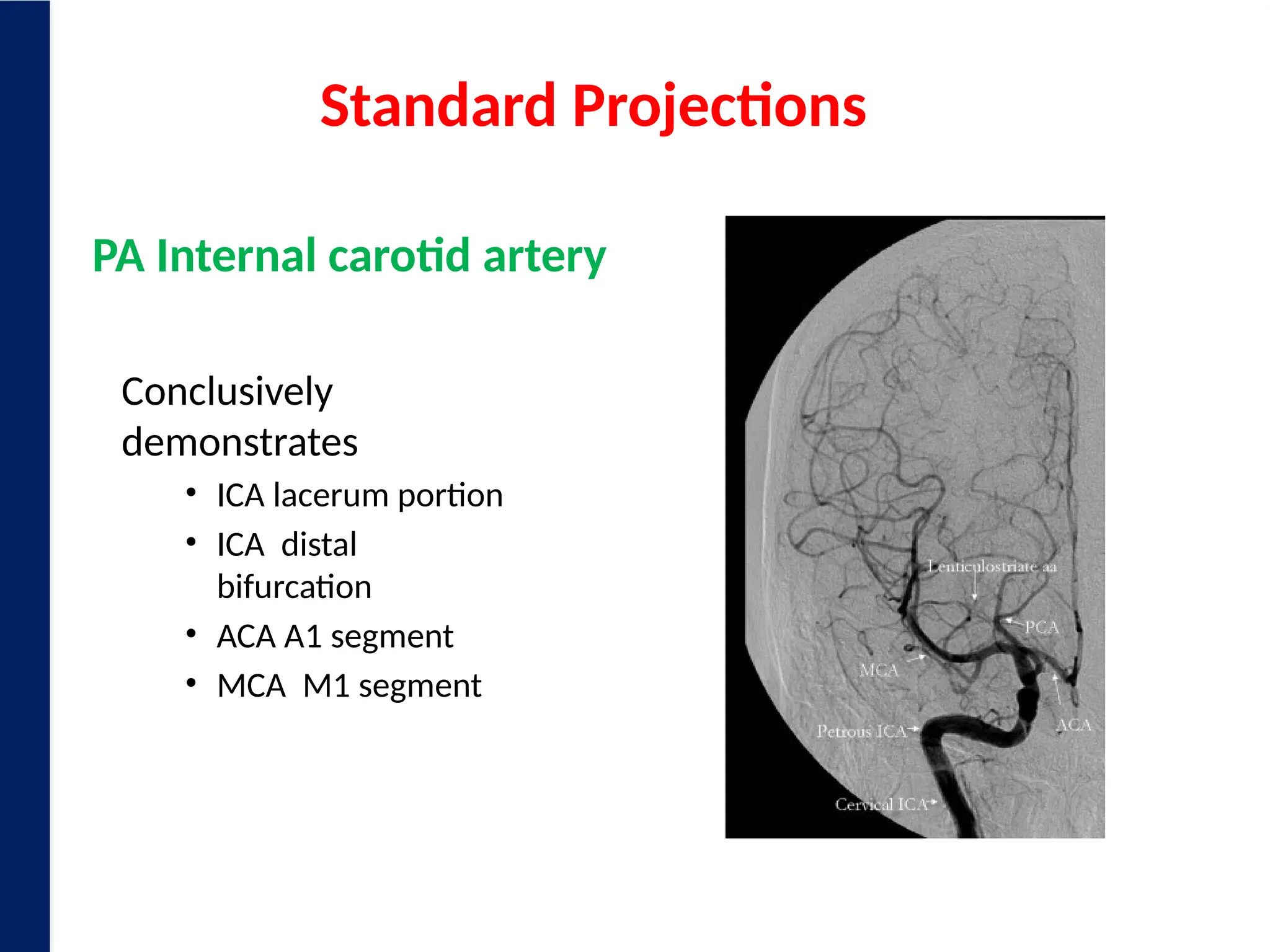VASCULAR INTERVENTIONAL STUDIES by joginder.pptx