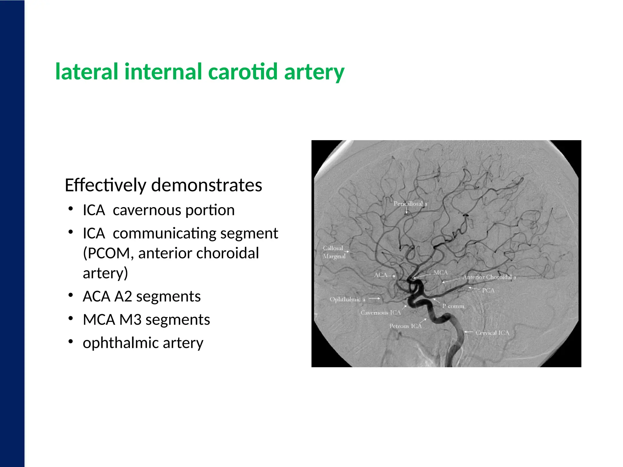 VASCULAR INTERVENTIONAL STUDIES by joginder.pptx
