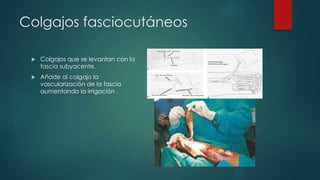 Vascularización cutanea y clasificación de los colgajos | PPTX