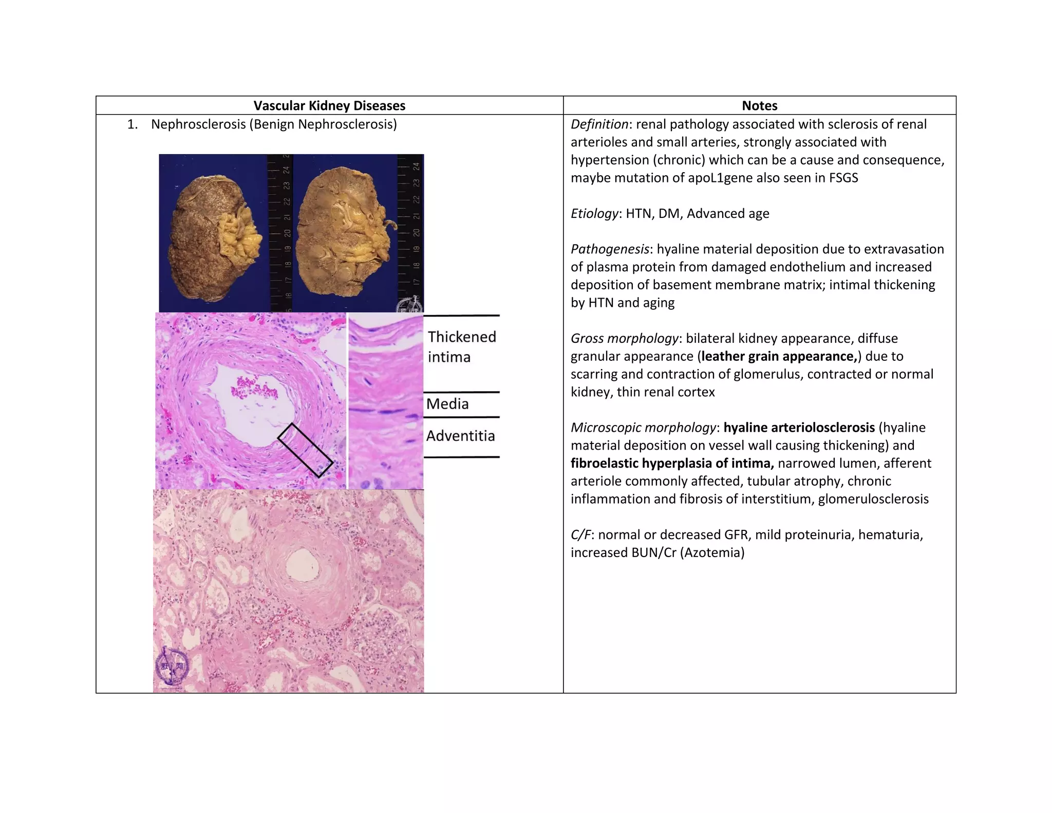 Vascular Kidney Diseases.pdf