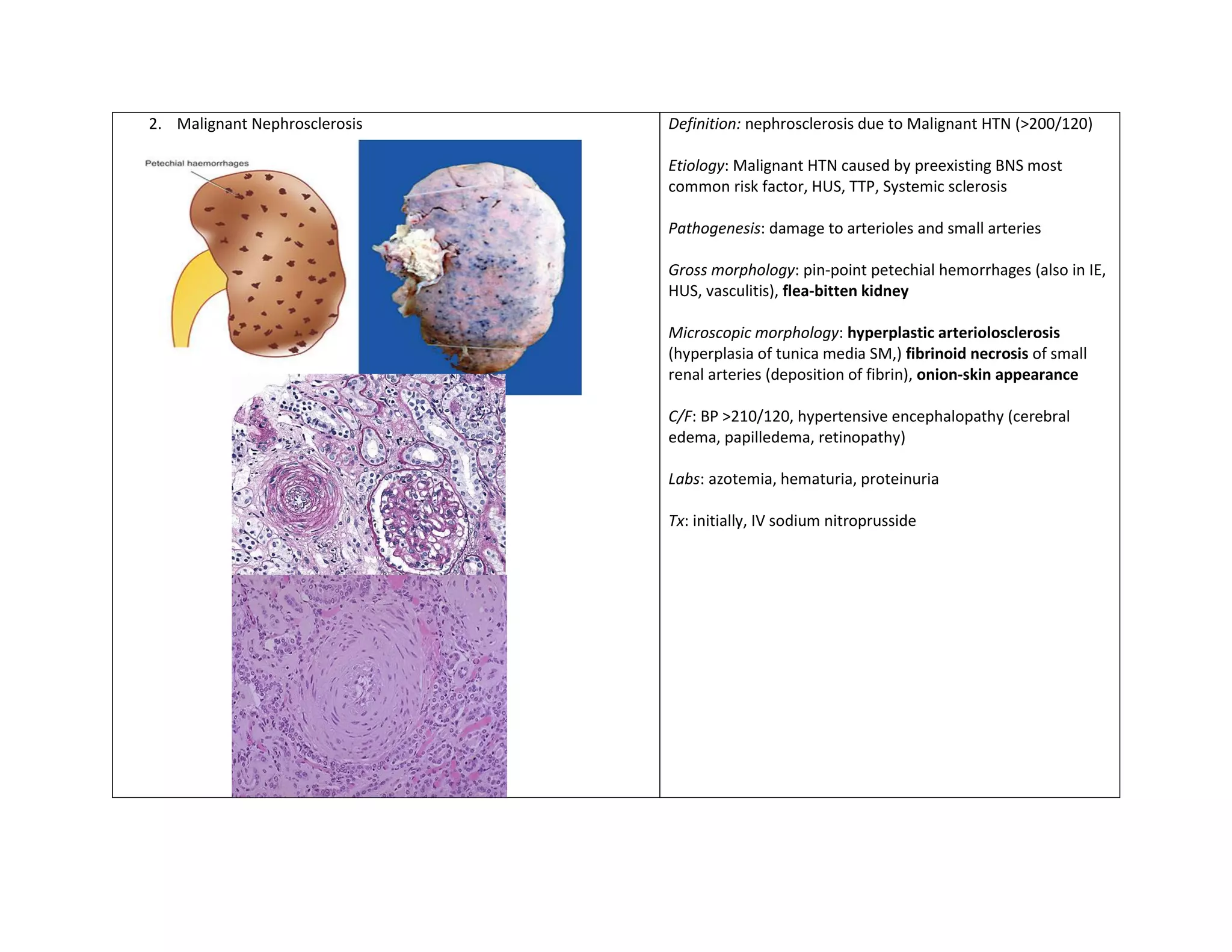 Vascular Kidney Diseases.pdf