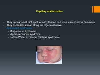 Vascular lesions in the head and neck regions | PPTX
