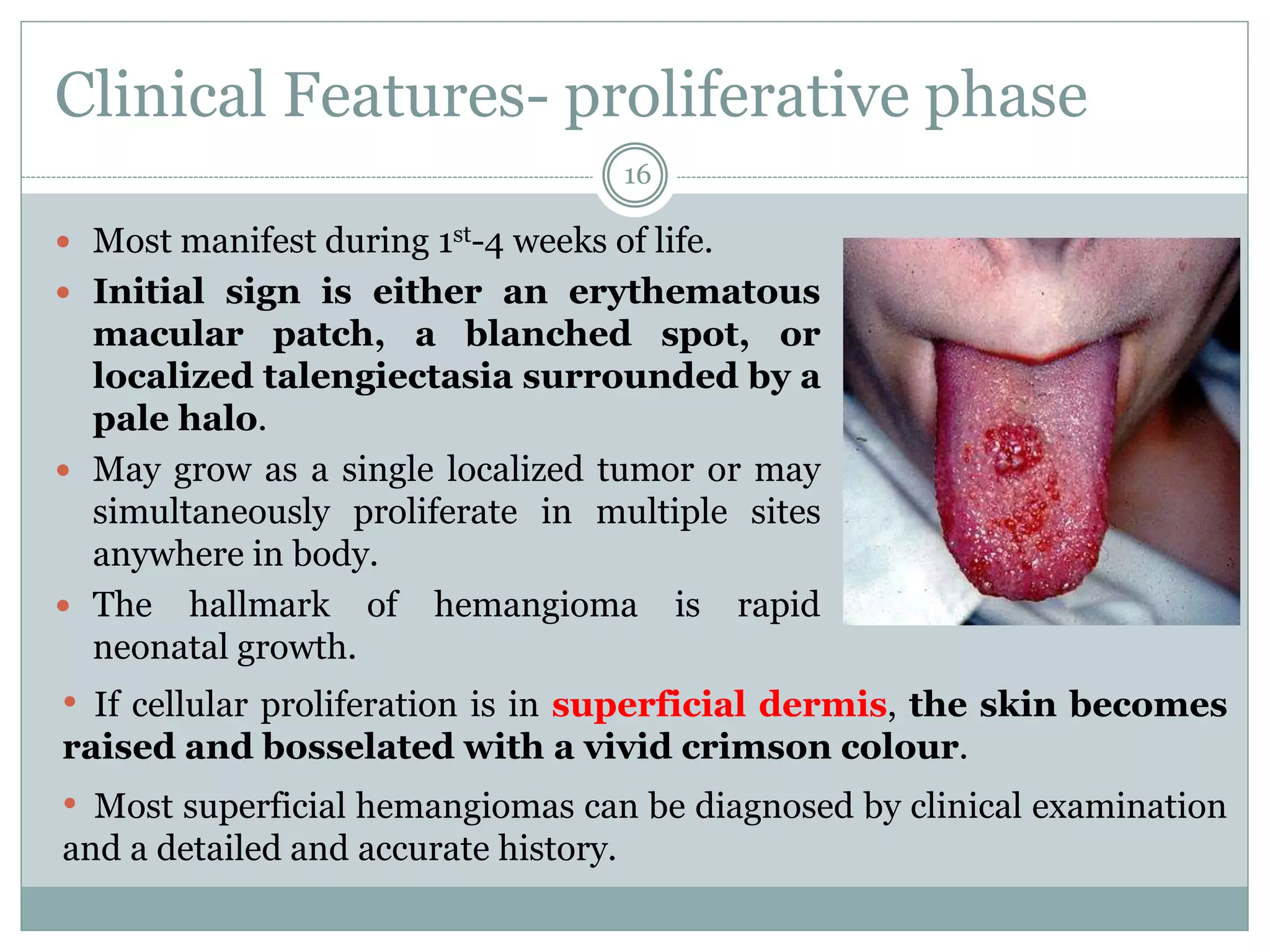 Vascular malformation | PPTX
