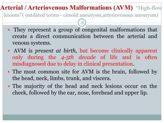 Vascular malformation | PPTX